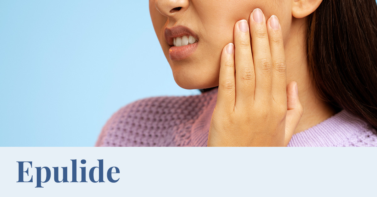 Epulide
